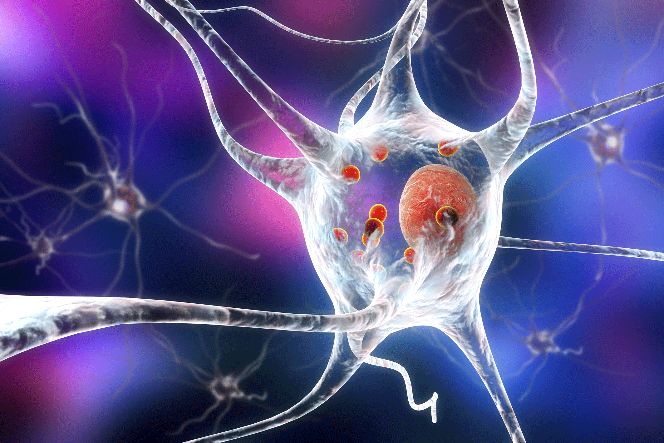 The NeuroMedical Center | Patient Education Library | Parkinson's Disease